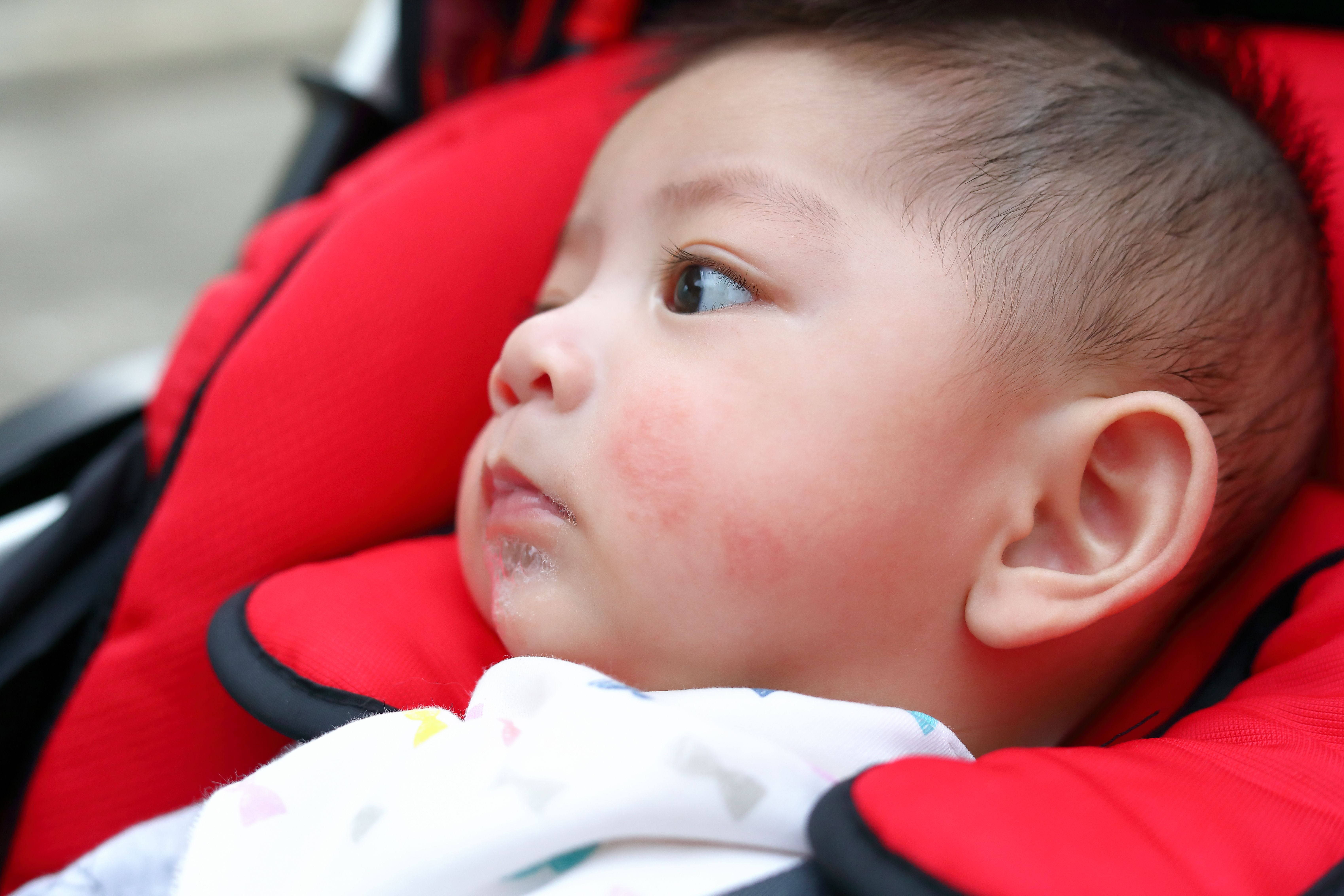 What Is A Teething Rash How To Treat It What Is A Teething Rash How To Treat It